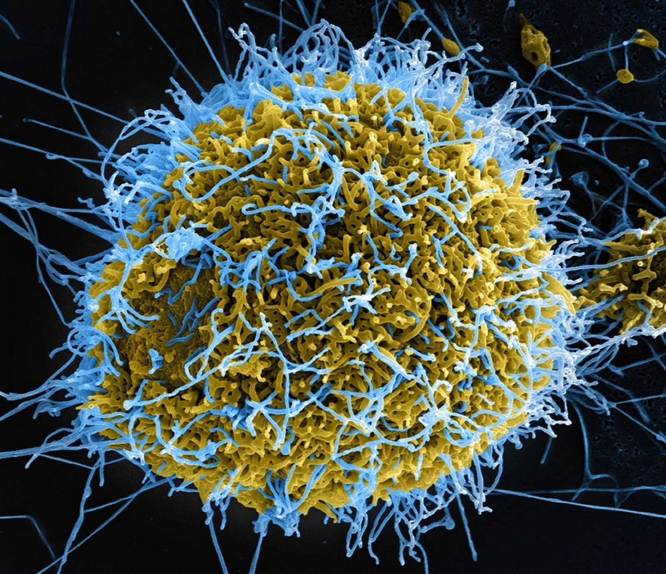 WHO Declares Ebola Emergency In DRC and Uganda ⋆ Pindula News